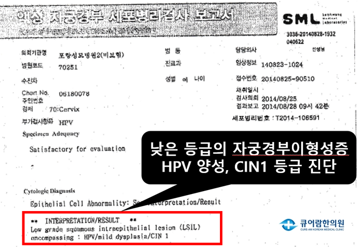 [치료사례] 자궁경부이형성증, 이형성세포 완전소실 : 네이버 블로그