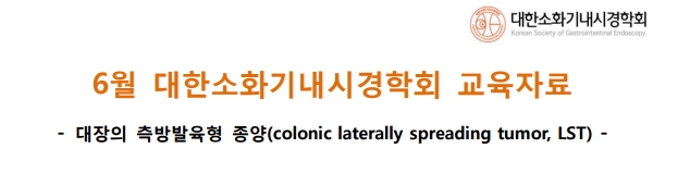 대장의 측방발육형 종양, Colonic laterally spreading tumor(LST) - 대한소화기내시경학회 교육자료 ...
