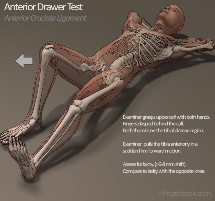 앞쪽 당기기 검사 _ Anterior drawer test(Special test) : 네이버 블로그