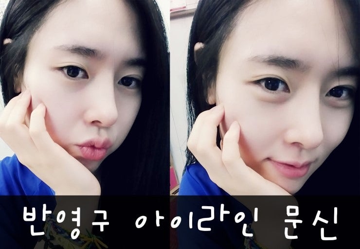 압구정 반영구 아이라인 문신 잘하는곳 ♥ 완전 대성공 네이버 블로그