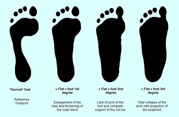 파이스선_Feiss line(Special test) : 네이버 블로그