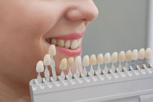 Dental Shade Taking 이란 ? ( 쉐이드 테이킹의 이론과 실제 ) : 네이버 블로그