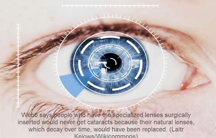 생체 렌즈(Ocumetics Bionic Lens)의 예상 가격 : 네이버 블로그