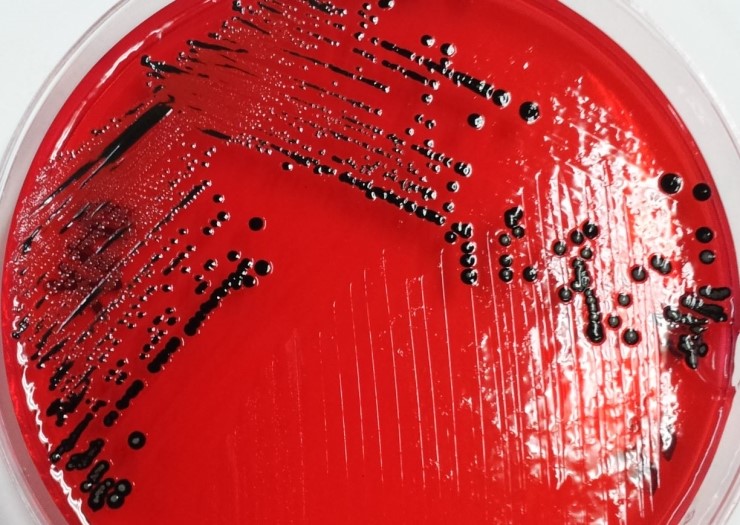 [살모넬라] XLD Agar배지, Salmonella spp. : 네이버 블로그