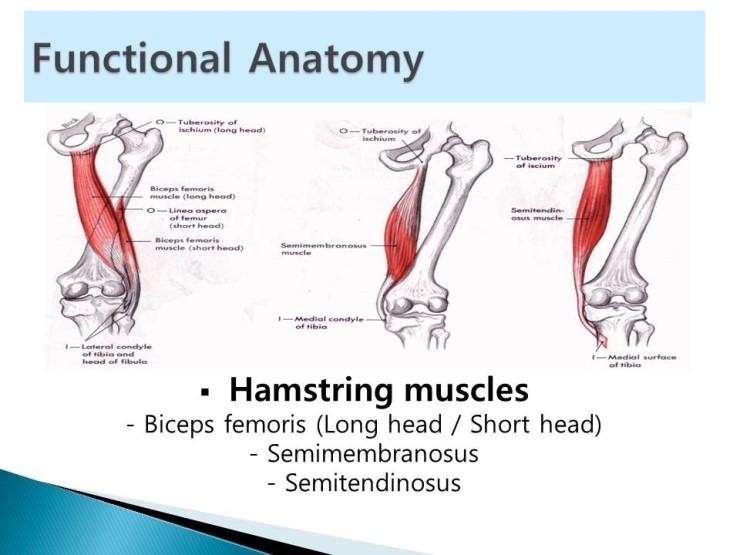 햄스트링 손상(hamstring tear) 기전 및 재활운동치료 : 네이버 블로그