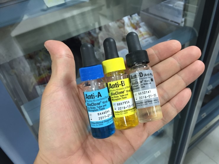 새로운 CIS-AB형이 국내에 발견, 기존의 시스-AB형과는 다른혈액형이라네요. : 네이버 블로그