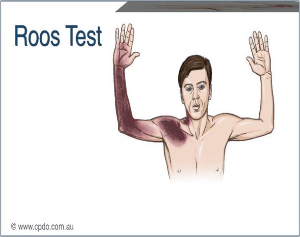 Roos test : 네이버 블로그