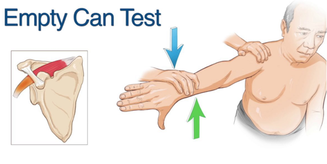 Empty can test : 네이버 블로그