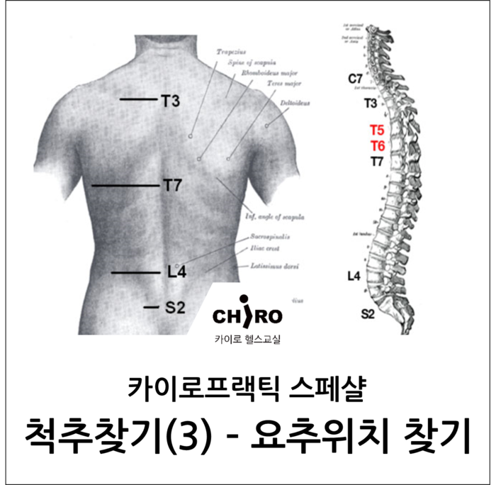 당산 교정 카이로프랙틱 스페샬 척추위치찾기03 요추위치 네이버 블로그