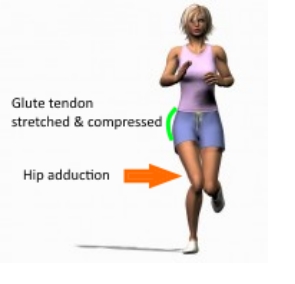 [이상근증후근, 좌골신경통 - Adduction Syndrome ] 다리를 꼬거나, 옆으로 누워 자지 말자! : 네이버 블로그