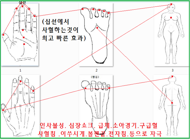 발관리스포츠 경락척추골반천골교정 네이버 블로그