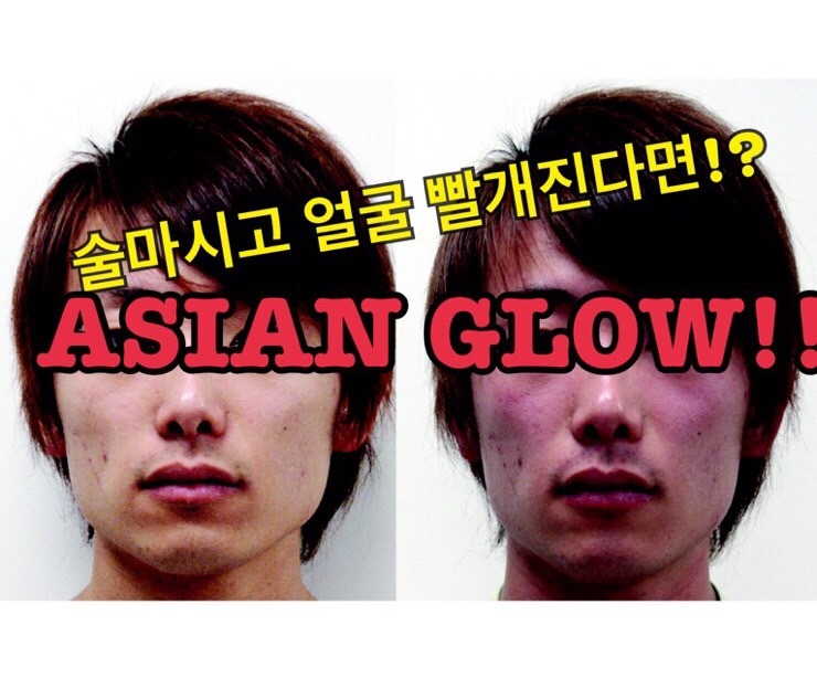 아시안들만 유독 술마시면 얼굴 빨개지는 현상은!? Asian Glow!! : 네이버 블로그