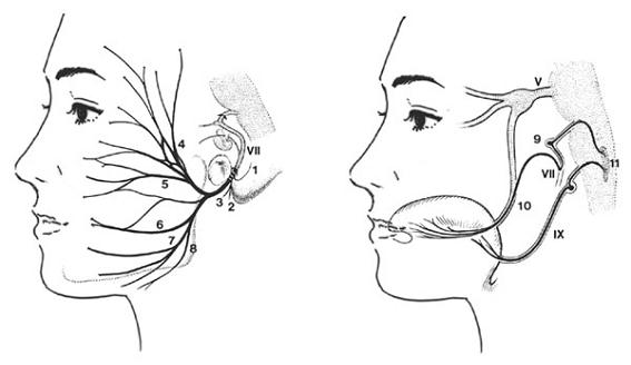 중간신경통 - Nervus intermedius neuralgia : 네이버 블로그
