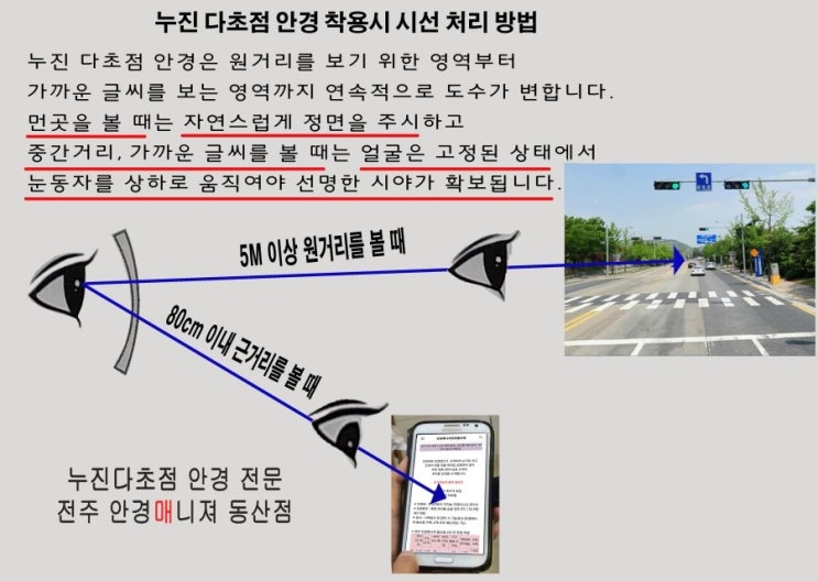 누진 다초점 안경 부적응 수직 사위 프리즘 처방과 선명한 영역이 넓은 고급 누진 다초점 렌즈로 해결 누진 다초점 안경 착용