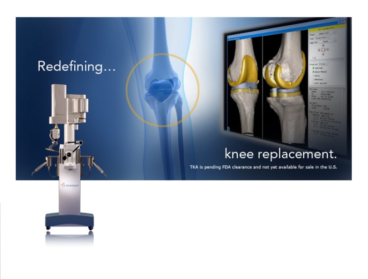 ROBODOC(로보닥) - 인공관절수술로봇이란? : 네이버 블로그