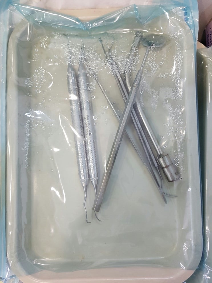 지아이 필링 충치치료 패인 곳 떼우기 cervical abrasion GI filling 치료 술식 진료 순서 : 네이버 블로그