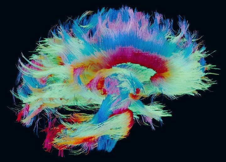 휴먼 컨넥톰 프로젝트(Human Connectome Project) : 네이버 블로그