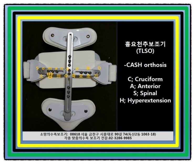 흉요천추보조기(TLSO) / CASH orthosis 케쉬 보조기 : 네이버 블로그