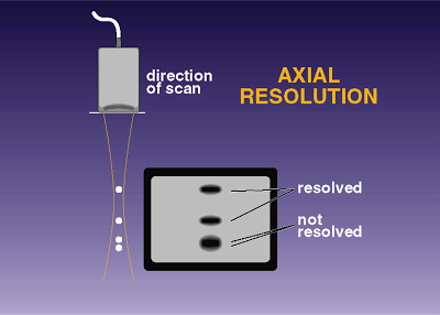 lateral/axial resolution : 네이버 블로그