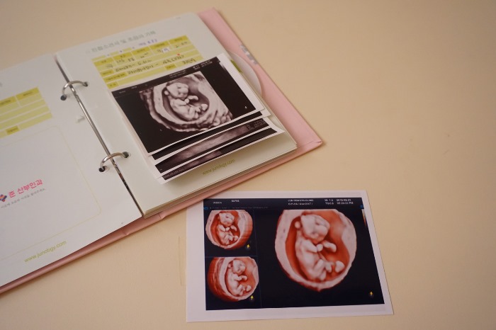 임신12주증상 1차기형아검사 하고왔어요 : 네이버 블로그
