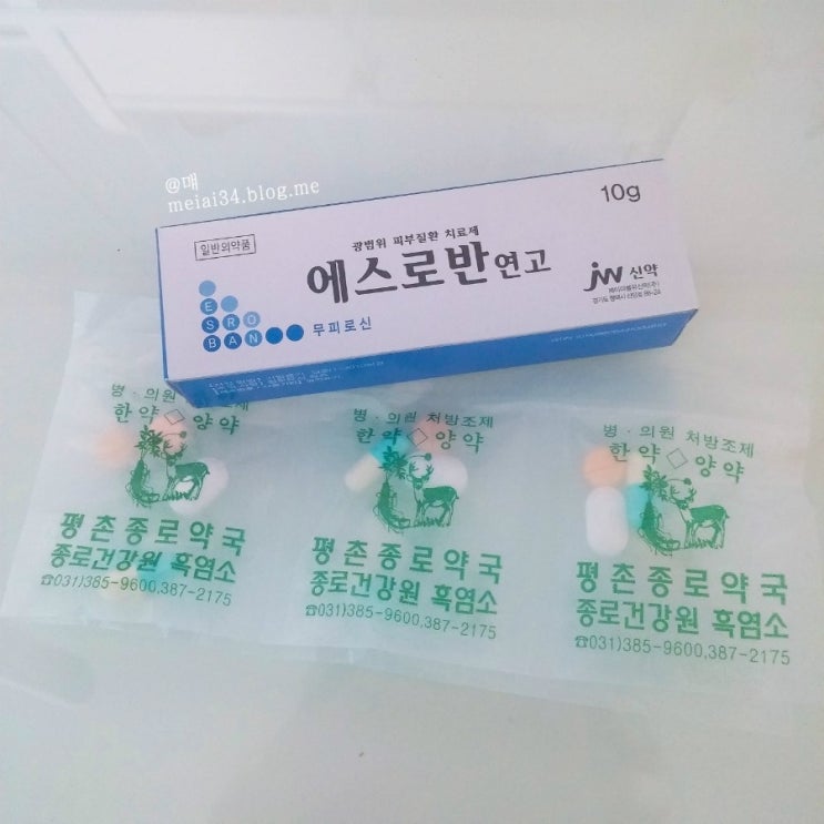 0830 일상 이너컨츠 피어싱 5개월 그 후 부제 염증 살튀 고름 끝에 막음 네이버 블로그