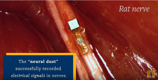뉴럴더스트(Neural Dust) 신경먼지.. 라고 불리는 인체 삽입용 센서 : 네이버 블로그