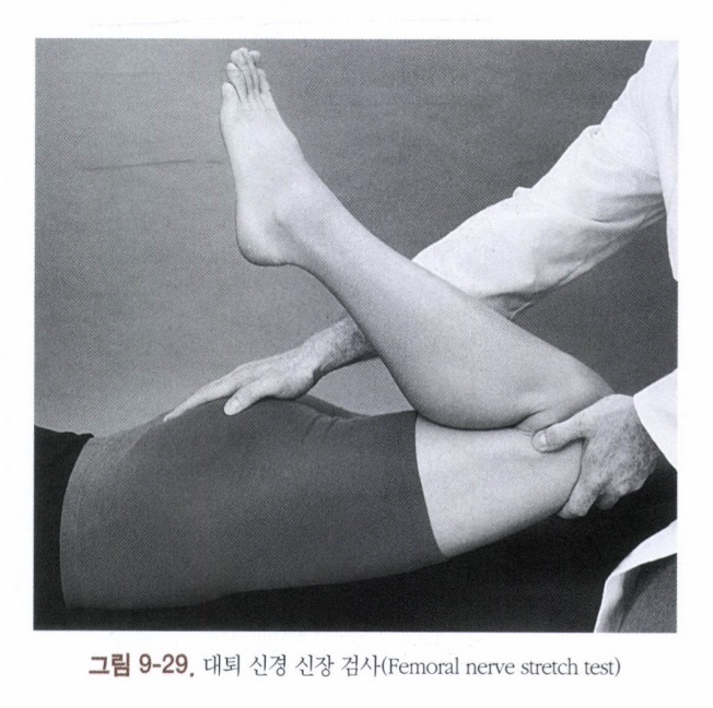 Femoral nerve stretch test : 네이버 블로그