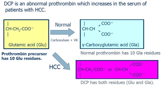 원발성 간암 표지자 PIVKA-II (DCP), AFP 검사 : 네이버 블로그