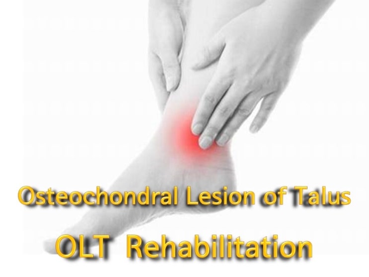 Osteochondral Lesion of Talus(OLT) Rehabilitation - 발목연골손상, 발목 박리성 골연골염 ...