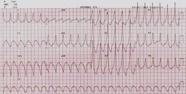 Concordance : 네이버 블로그