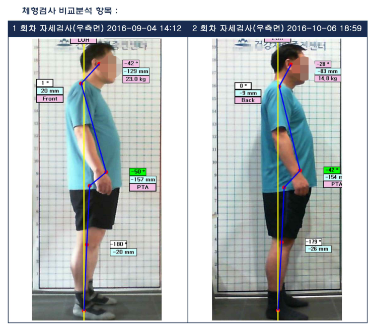 인천 송도 Pt송도 피티 체형교정 자세교정 Pt 전문 퍼스널 트레이닝 3탄거북목 운동 목디스크 운동 일자목 운동 변화