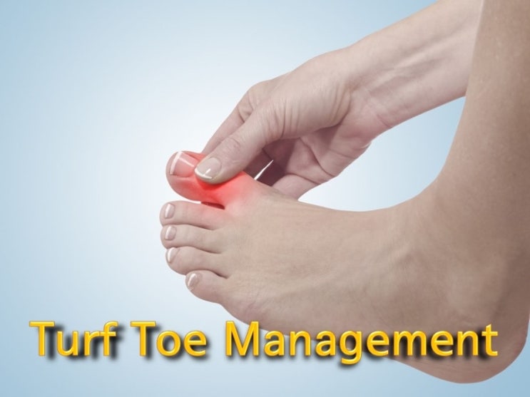 Turf Toe Management - 잔디 발, 잔디발가락, 제1중족지관절 염좌 재활운동 : 네이버 블로그