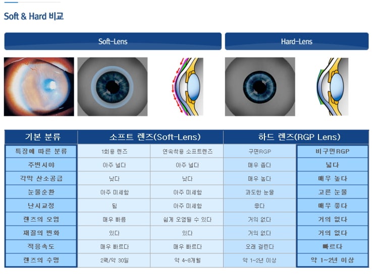 공부하는안경원 하드렌즈가 궁금해요 서울대입구역안경원 로데오 네이버 블로그