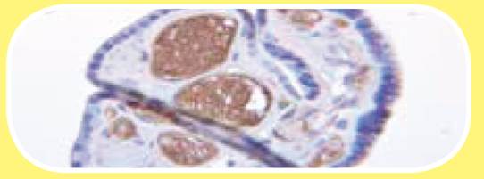 [Quartett] 간암 표지 단백질 AFP antibody (IHC용) : 네이버 블로그