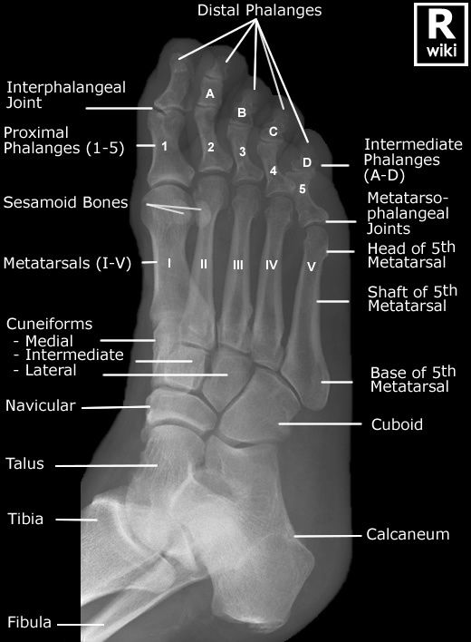 X Ray 04 Foot 네이버 블로그