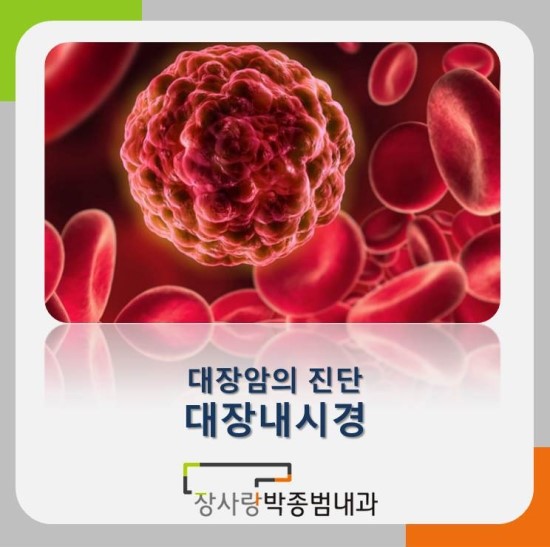 청주내과 대장암 속속들이 알아보기 5 대장내시경 검사가 필요한 경우 네이버 블로그