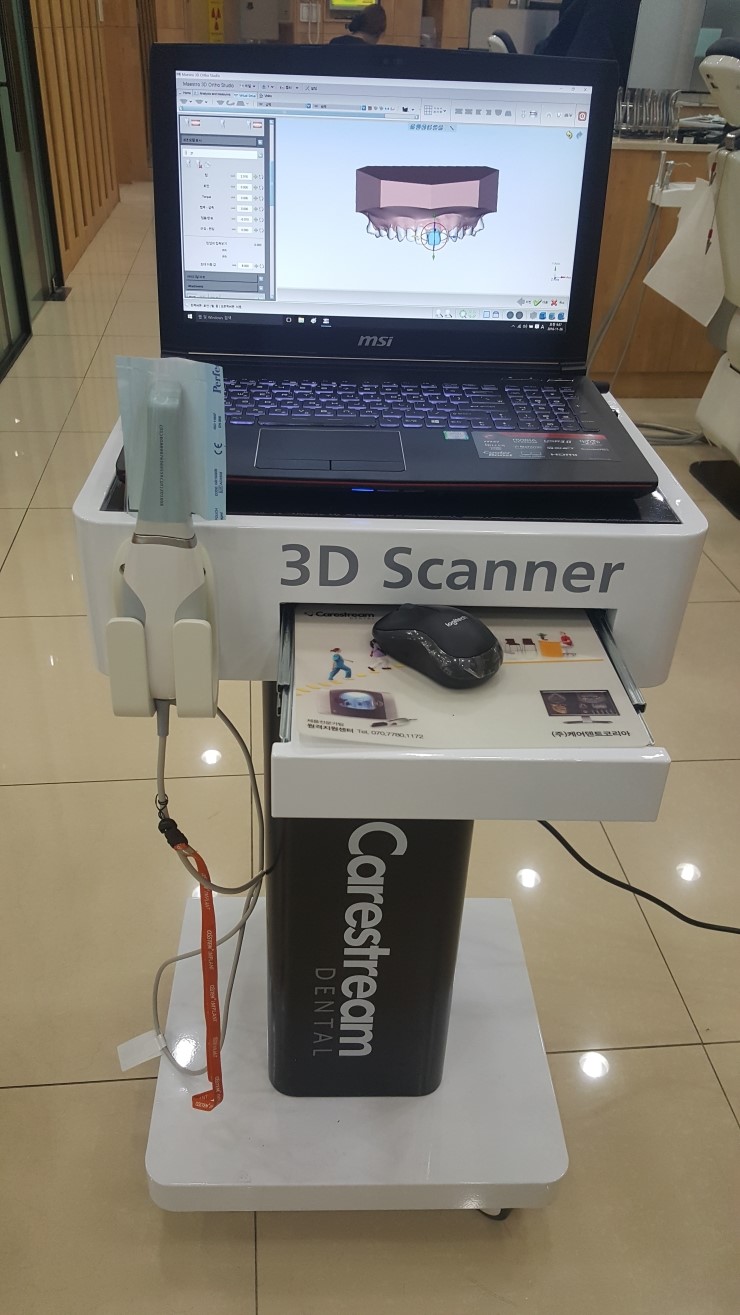 구강 스캐너 케어스트림 cs3600 : 네이버 블로그