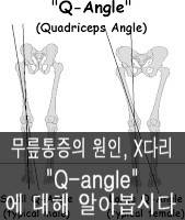 [무릎통증, 무릎통증원인, X다리] Q-angle에 대해 알아봅시다! [슬림앤스트롱 고준영트레이너, 자세교정운동] : 네이버 블로그