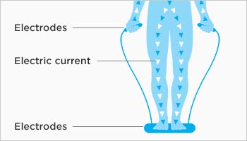 인바디(InBody), 생체전기저항분석(BIA) 검사 및 체지방률에 따른 비만. : 네이버 블로그