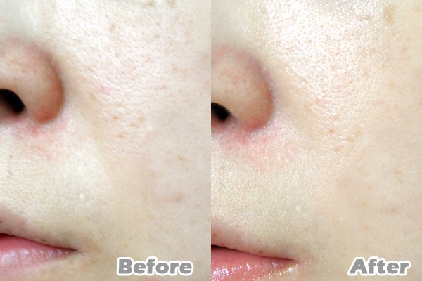 인생 선크림 Get 백탁번들거림 없는 자외선 차단제 식물나라 산소수 피팅 선크림 Spf50 Pa 네이버 블로그