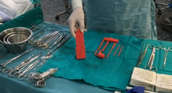 3D printed surgical instruments : 3D printed medical devices : 네이버 블로그