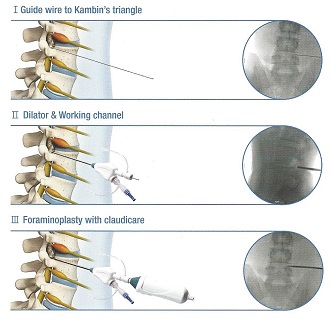 Claudicare : 네이버 블로그