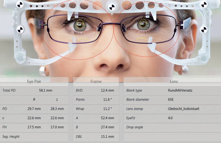 자이스 아이터미널2 zeiss i-terminal2 기계 설명! : 네이버 블로그