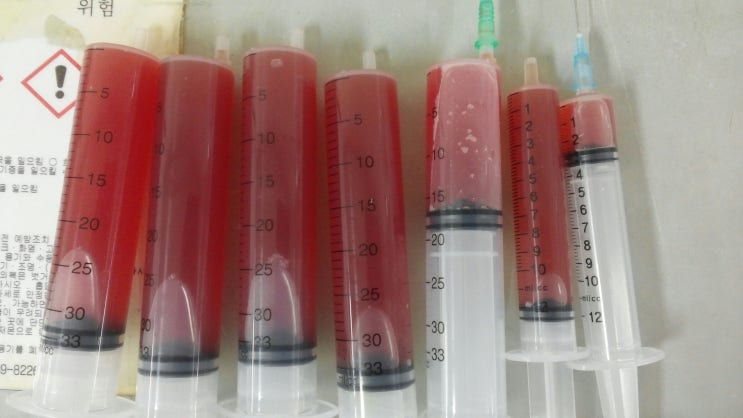 장액혈액성, Serosanguineous : 네이버 블로그