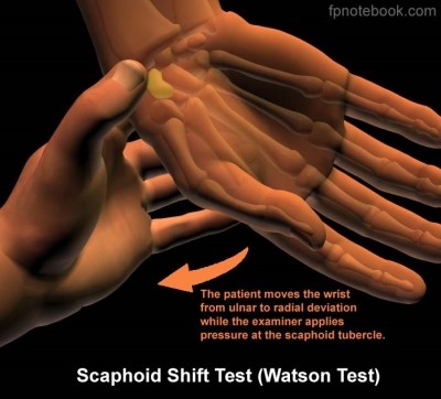 Scaphoid shift test : 네이버 블로그