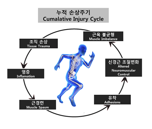 누적손상주기(Cumulative injury cycle)- [부산 화명동PT, 화명PT, 화명동 개인트레이닝, 화명동 다이어트 ...