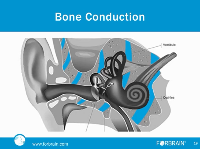 [2편] 포브레인(Forbrain) 구성요소_공기전도 및 골전도 : 네이버 블로그