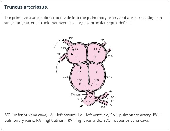 persistent truncus arteriosus : 네이버 블로그