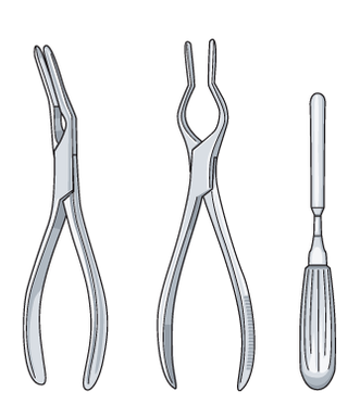 DS Nasal bone reduction : 네이버 블로그