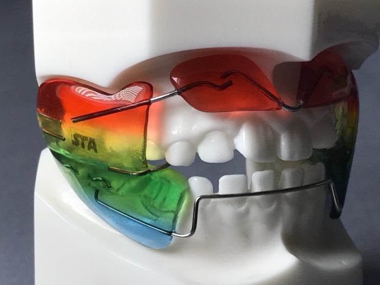 Frankel appliance : 네이버 블로그